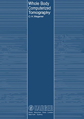 Whole Body Computerized Tomography by Wegener, Otto H.: Good (1983) 1st ... Whole Body Computerized Tomography by Wegener, Otto H.: Good (1983) 1st ...