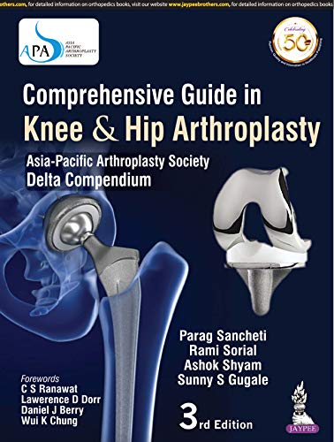 Comprehensive Guide in Knee & Hip Arthroplasty - Sancheti, Parag ... Comprehensive Guide in Knee & Hip Arthroplasty - Sancheti, Parag ...
