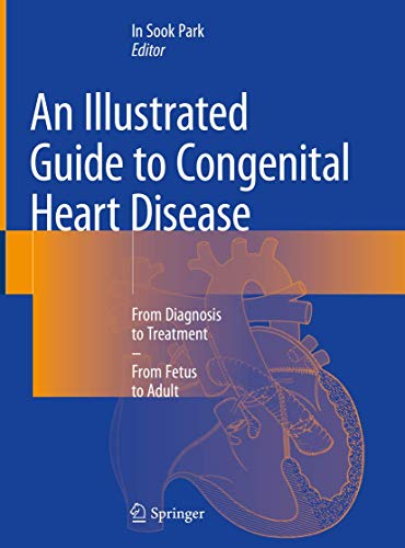 An Illustrated Guide To Congenital Heart Disease From Diagnosis To