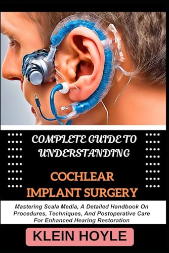 COMPLETE GUIDE TO UNDERSTANDING COCHLEAR IMPLANT SURGERY: Mastering ... COMPLETE GUIDE TO UNDERSTANDING COCHLEAR IMPLANT SURGERY: Mastering ...