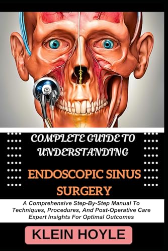 COMPLETE GUIDE TO UNDERSTANDING ENDOSCOPIC SINUS SURGERY: A ... COMPLETE GUIDE TO UNDERSTANDING ENDOSCOPIC SINUS SURGERY: A ...